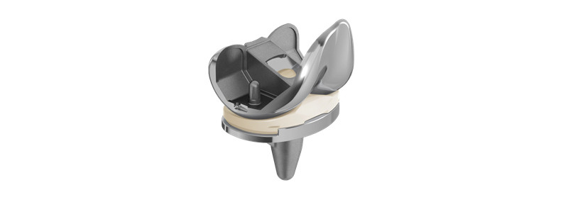 ATTUNE Knee System - Medical Design and Outsourcing