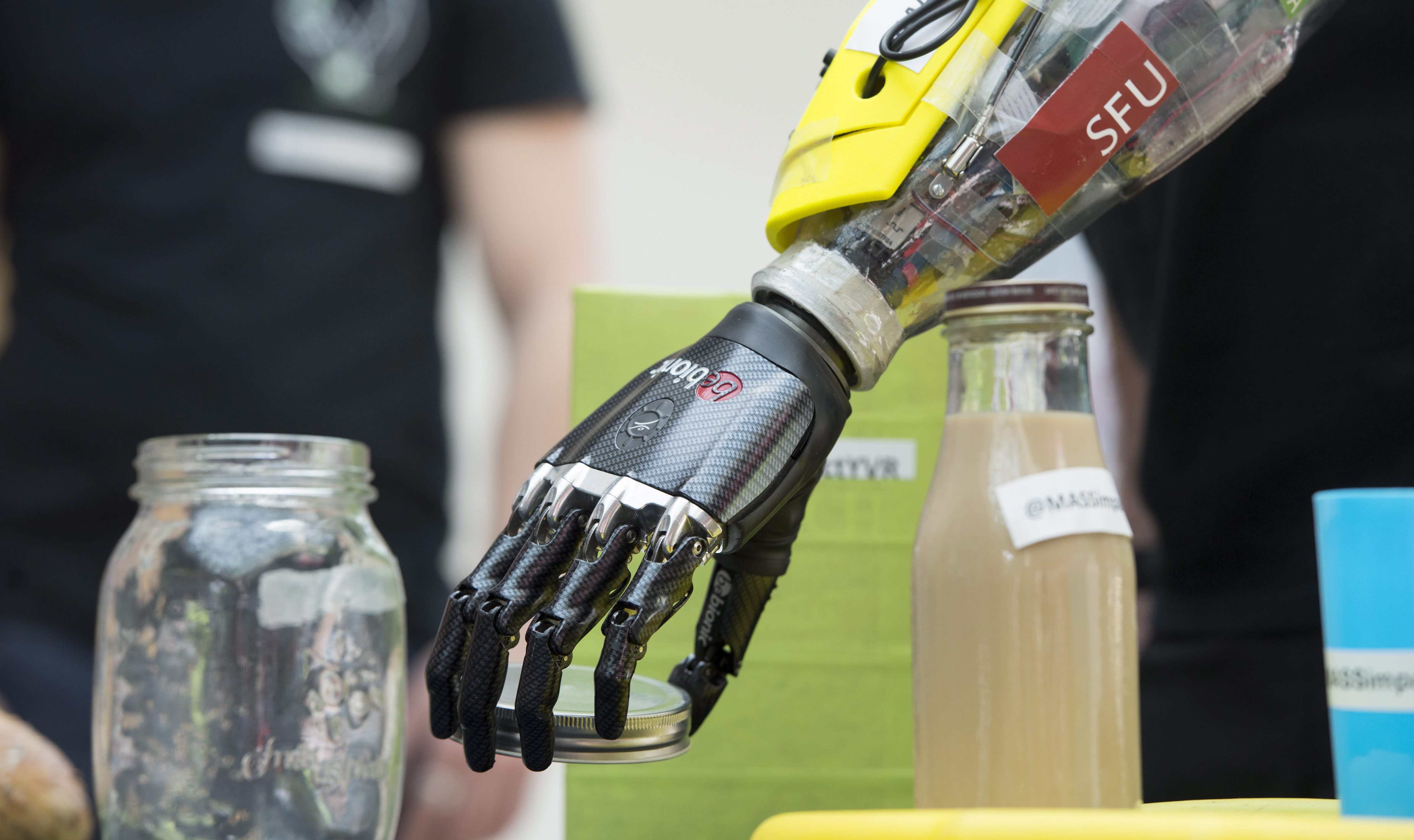 Photos of the Day: Bionic Hand Developed for World's First Cyborg ...