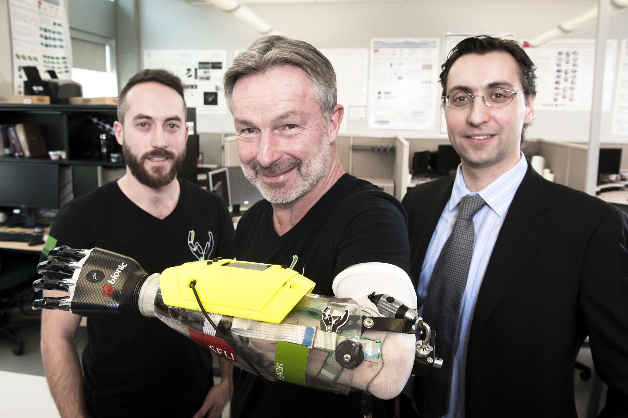 Photos of the Day: Bionic Hand Developed for World's First Cyborg ...
