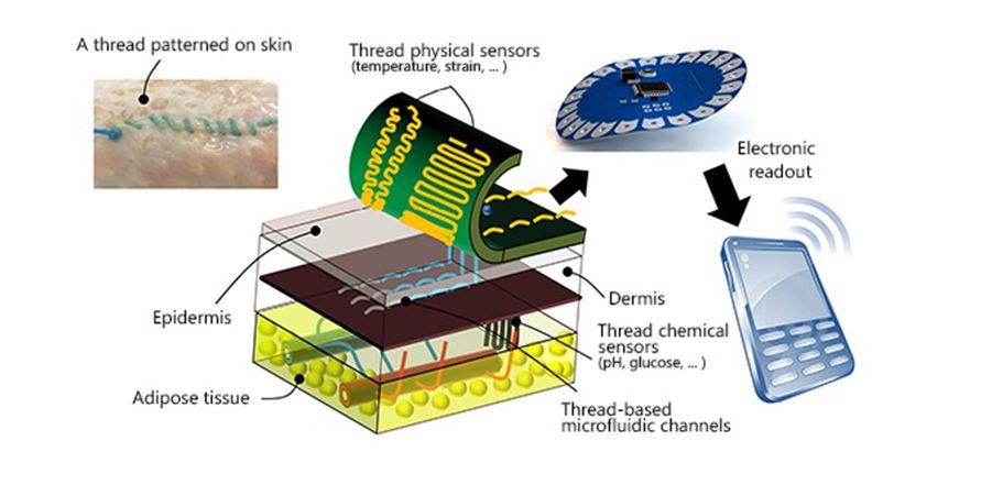 Researchers Develop Smart Sutures That Deliver Diagnostic Data ...