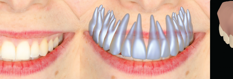 A Handful of Photos Yields a Mouthful of (Digital) Teeth - Medical ...