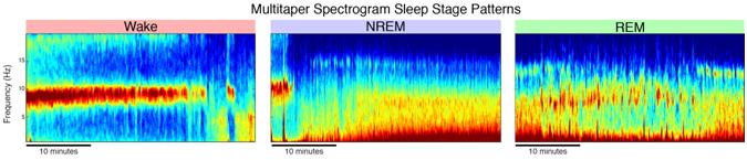 Advanced EEG Analysis Reveals the Complex Beauty of the Sleeping Brain ...