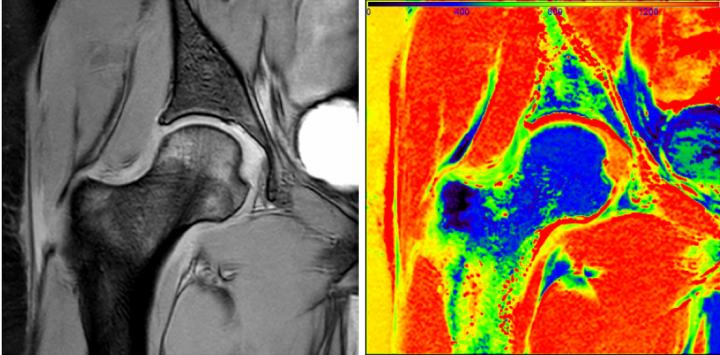 Real-Time MRI Analysis Powered by Supercomputers - Medical Design and ...