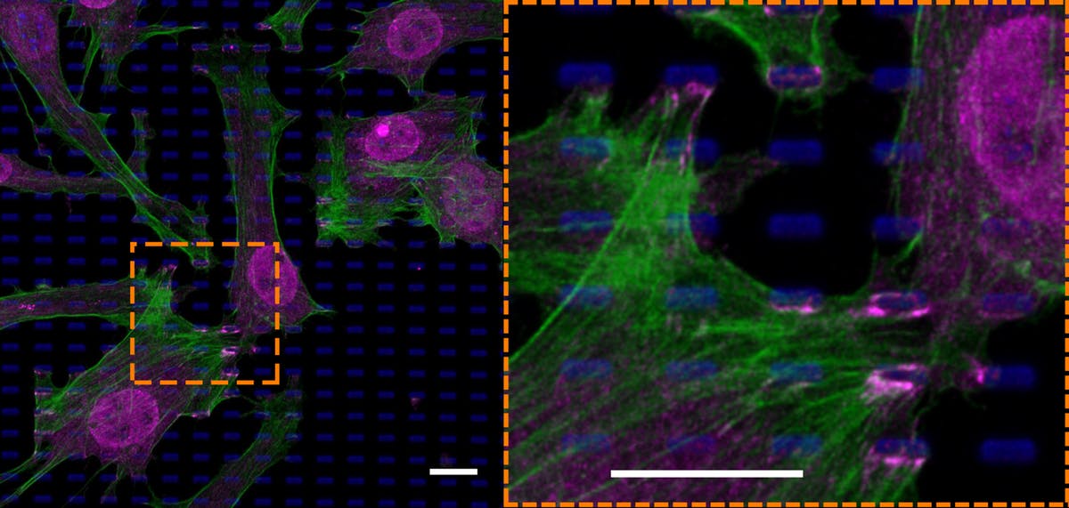 Life-Like Stretching of Cells - Medical Design and Outsourcing