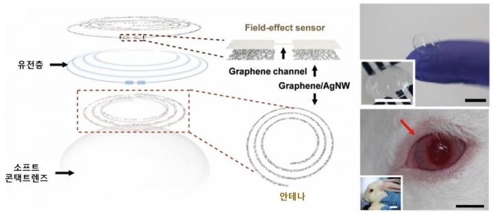 “Smart Contact Lens Sensor” For Diabetic and Glaucoma Diagnosis ...