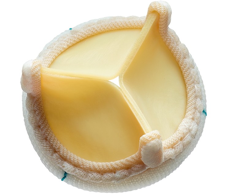 Photo of the Day: Pericardial Aortic Surgical Valve Approved - Medical ...