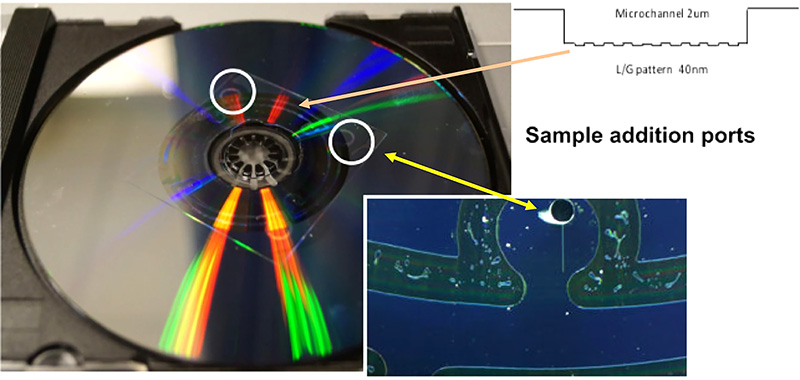 Photo of the Day: Blu-Ray Technology for Cancer Diagnosis - Medical ...