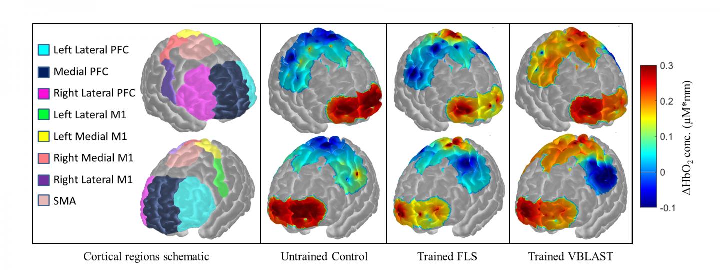 Noninvasive Brain Imaging Shows Readiness of Trainees to Perform ...