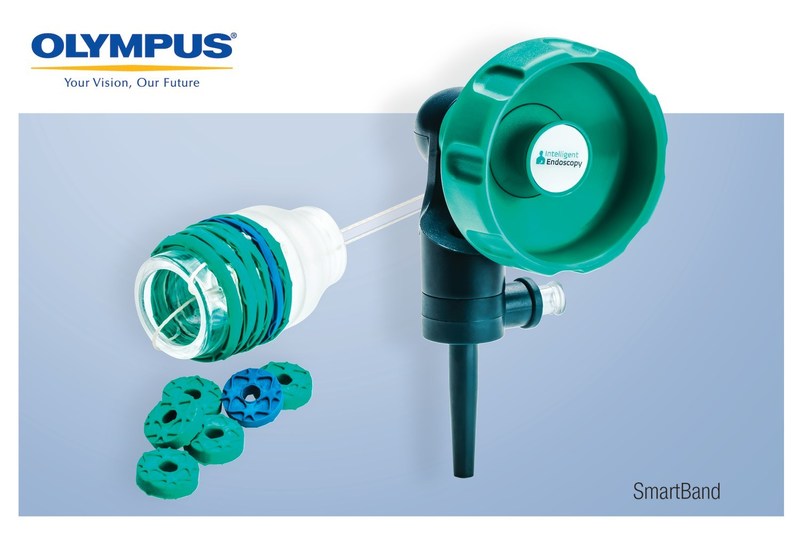 Olympus Adds SmartBand Multi-Band Ligation Kit To EndoTherapy Portfolio ...